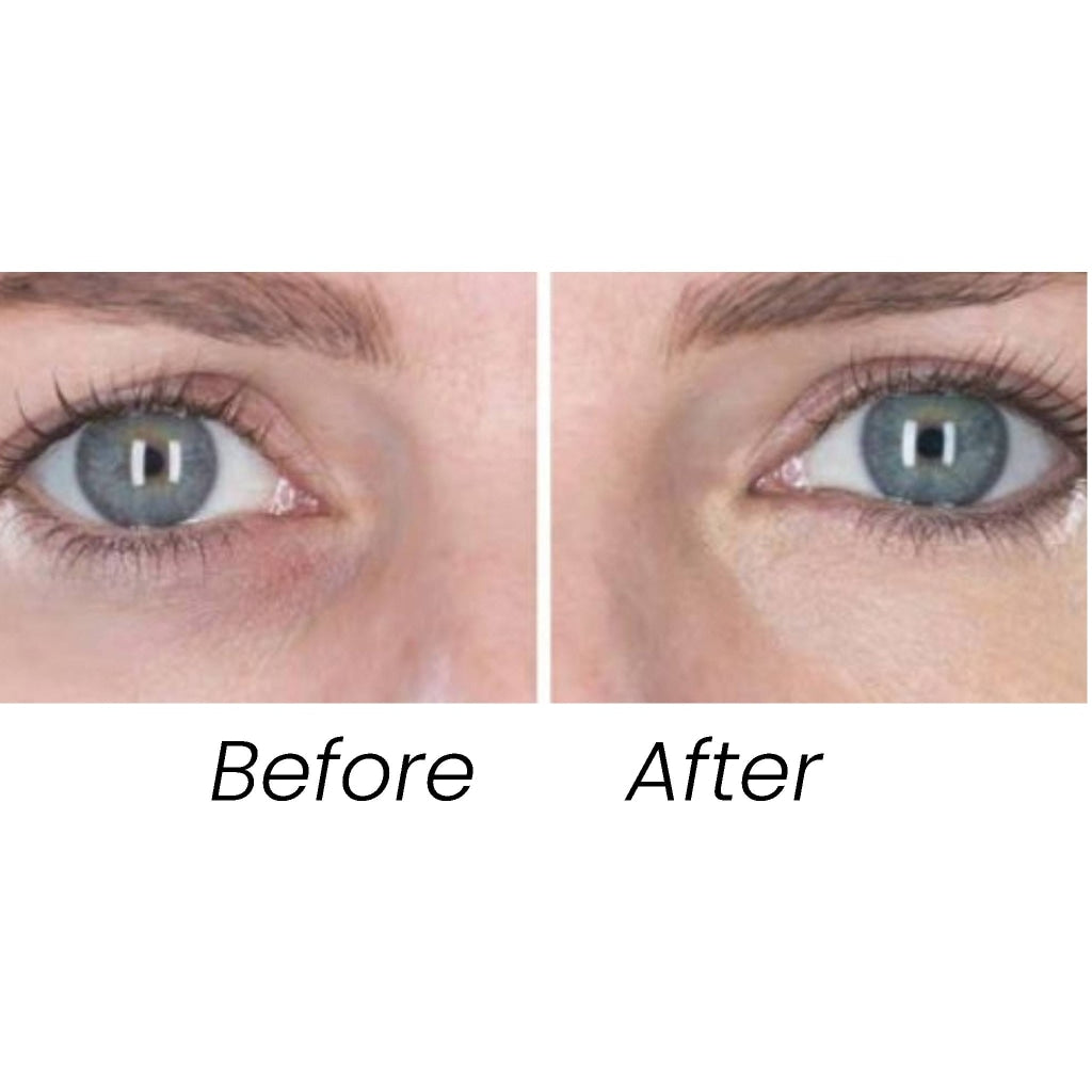 FlawLess EyeRetouch Serum | Transformulas